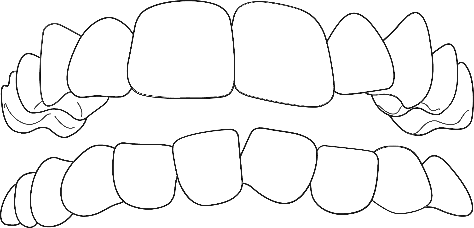 Common Orthodontic Issues | Premiere Orthodontics