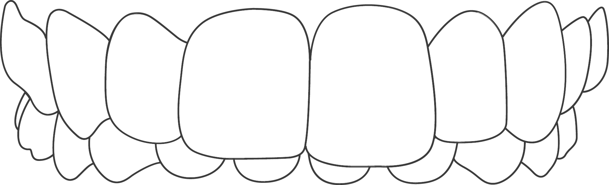 Common Orthodontic Issues | Premiere Orthodontics